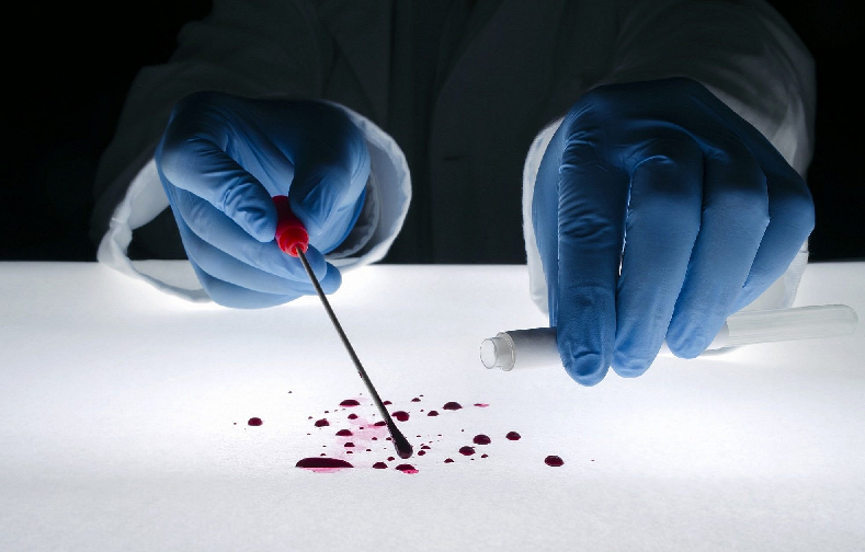 Blood and Body Fluid Collection/Detection – medtechforensics