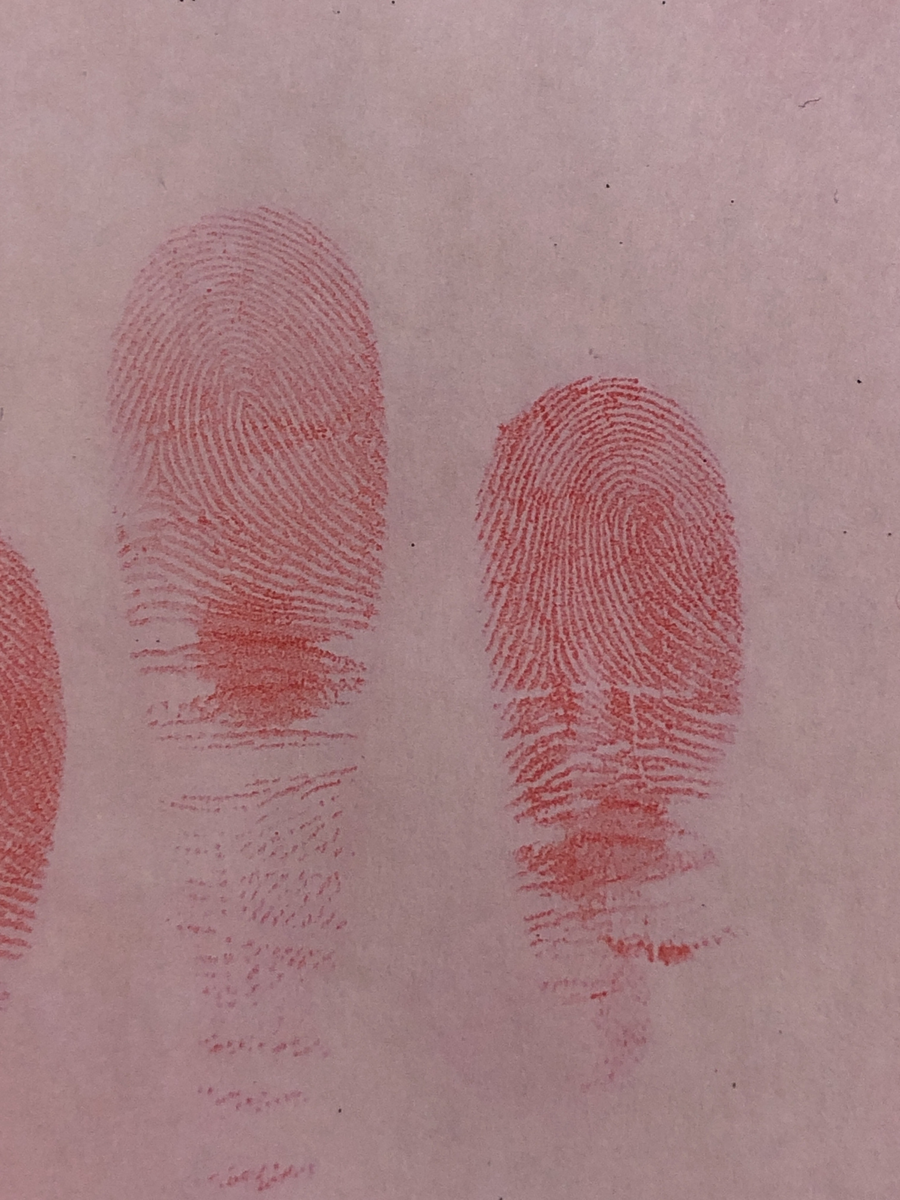 Oil Red O Lipid Stain – medtechforensics