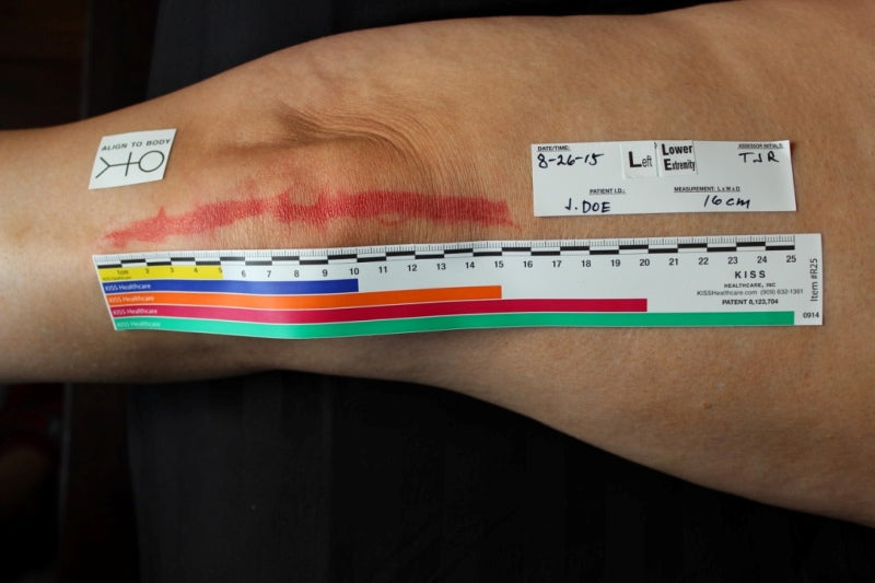 Stick Figure – medtechforensics