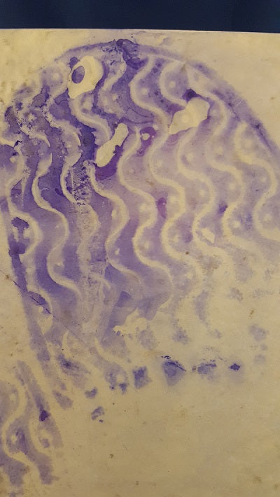 Enhancement of Bloody Prints – medtechforensics